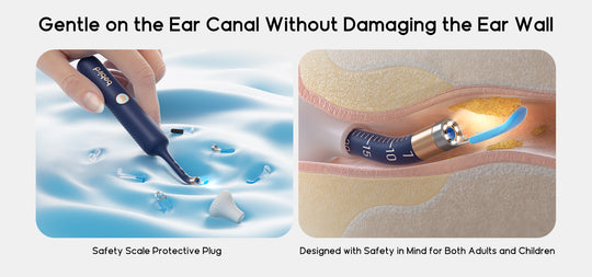 Bebird EarSight Plus – Smart Ear Wax Removal with Camera | FDA-Cleared