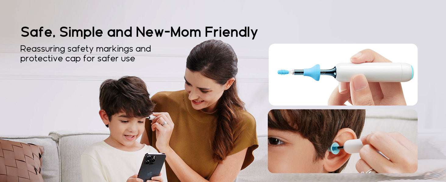 Bebird EarSight Complete | All-in-One Ear Wax Removal Kit | FDA-Cleared