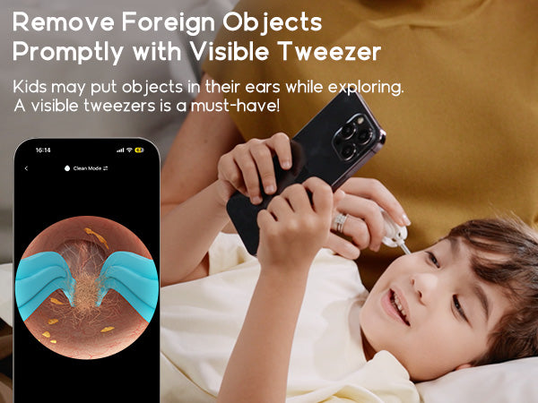 Bebird EarSight Complete | All-in-One Ear Wax Removal Kit | FDA-Cleared