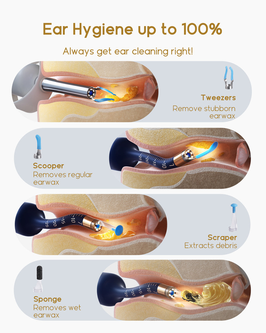Ear Wax Removal Tools - Bebird EarSight Plus