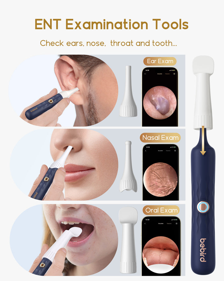 Bebird EarSight Plus – Smart Ear Wax Removal with Camera | FDA-Cleared