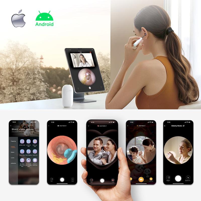 Bebird EarSight Complete | All-in-One Ear Wax Removal Kit | FDA-Cleared