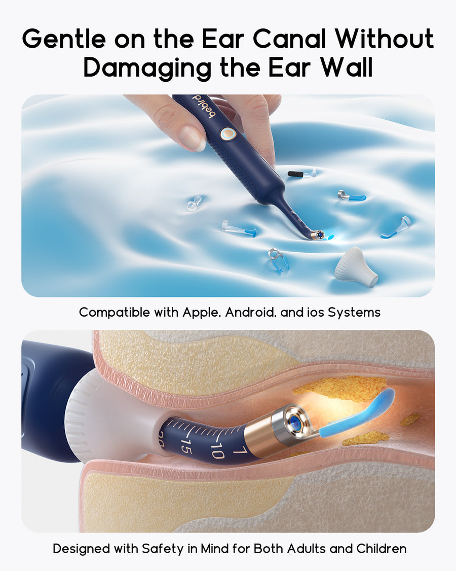 Bebird EarSight Plus – Smart Ear Wax Removal with Camera | FDA-Cleared