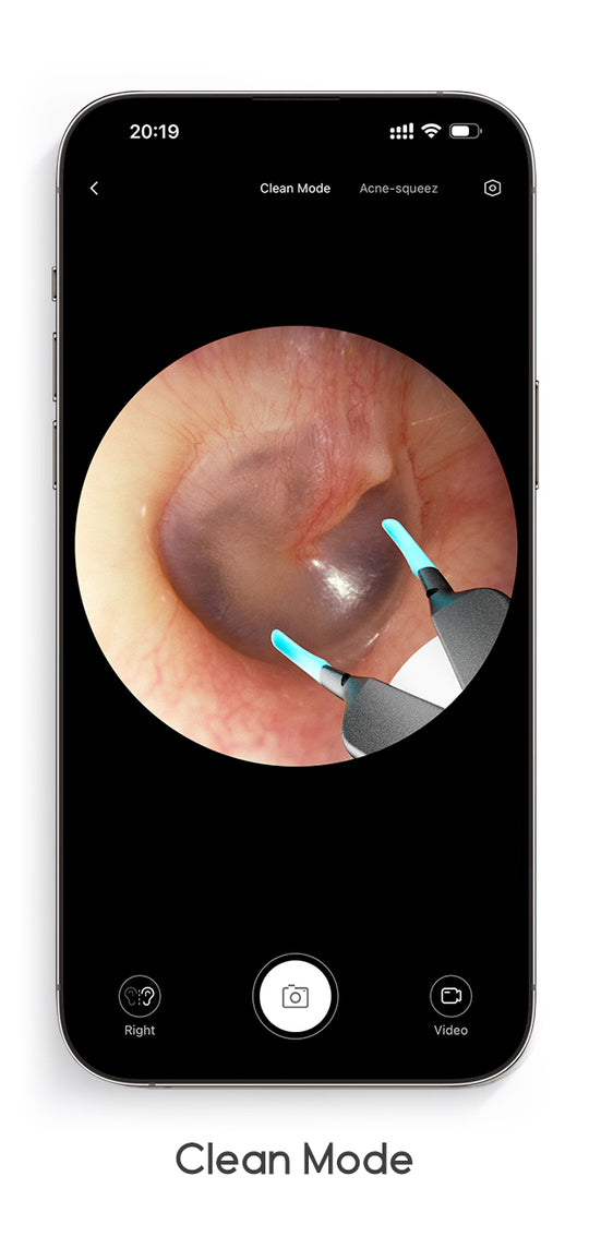 Bebird® Official | Pioneering Visual Ear Cleaner – bebird